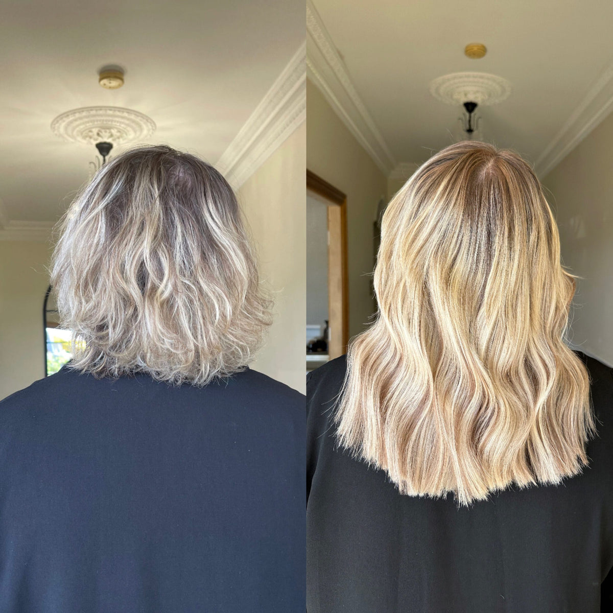 Hair Loss After Chemotherapy: What Are My Options? – Yovanka Loria